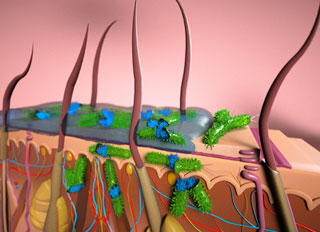 Breakthrough antibacterial approach could resolve serious skin ...