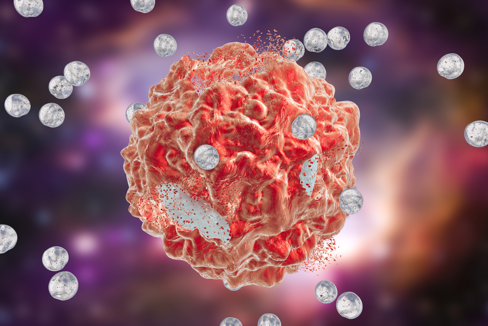 Nanoparticle-Based Cancer Treatment: A Look at its Origins and What’s ...