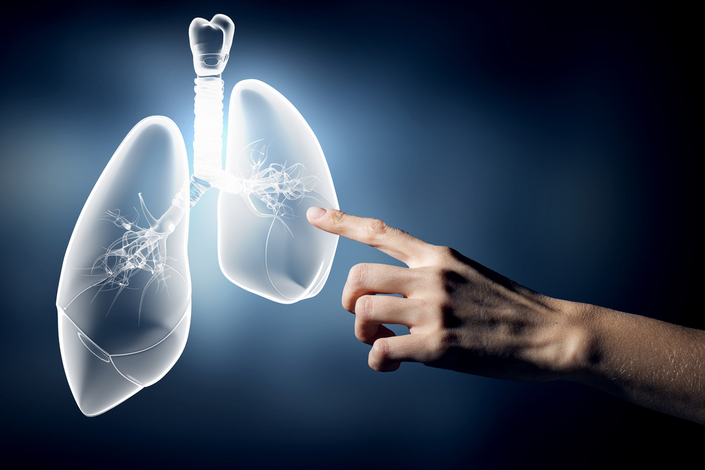 FDA Approves Merck's Keytruda in Metastatic NSCLC as First-Line ...