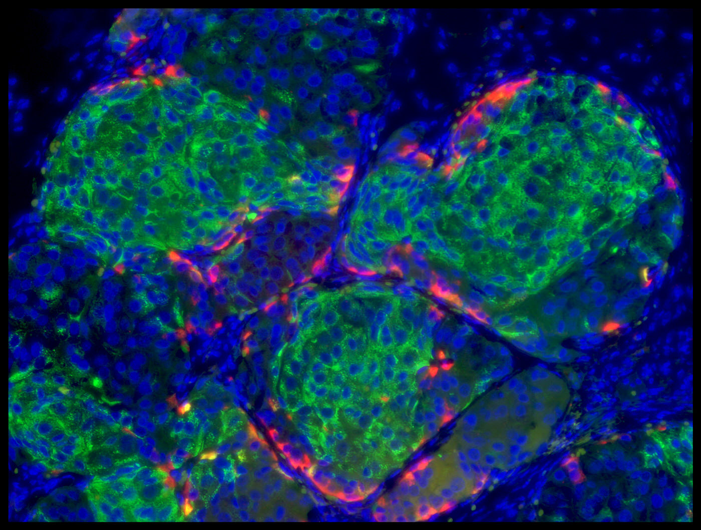 Generating Insulin-Producing Beta Cells in the Pancreas - Drug ...