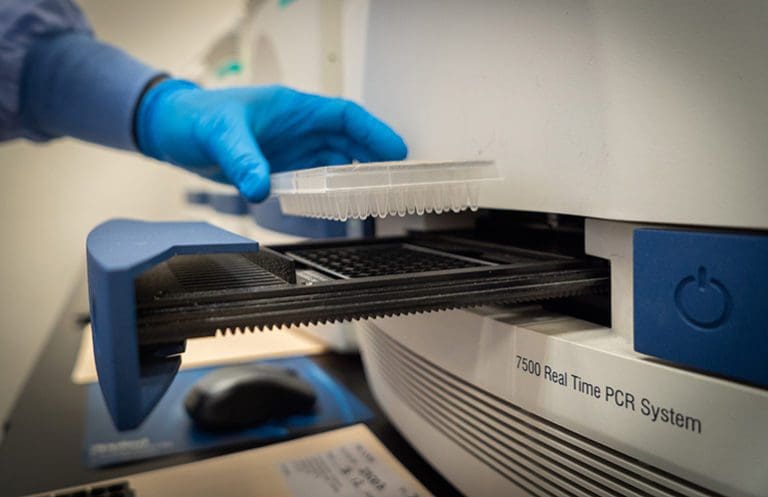 Quest Diagnostics launches patient-ordered COVID-19 antibody test ...