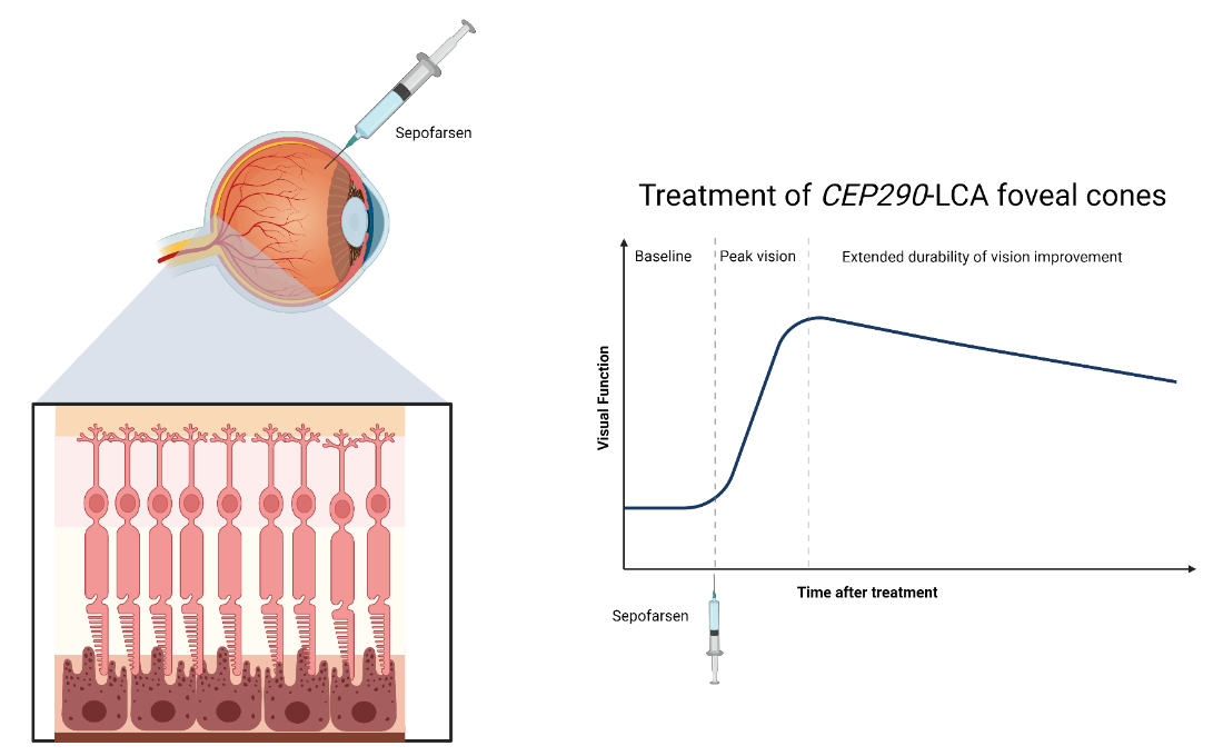 Investigational drug gives sight to patient with inherited form of ...