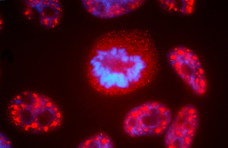 The promise of allogeneic and autologous cell therapy