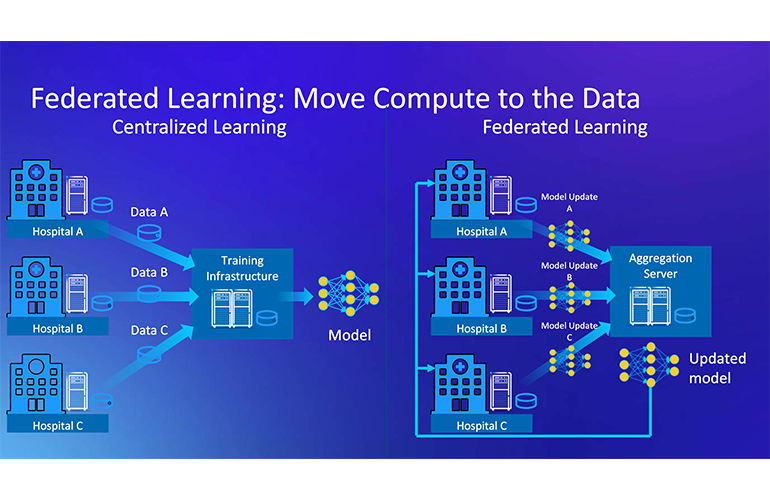 Intel federated learning pact boosted glioblastoma detection