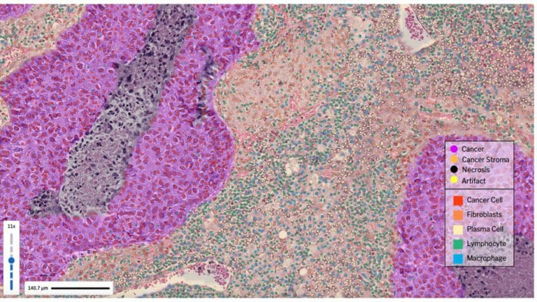 PathAI and Roche partner on AI companion diagnostics