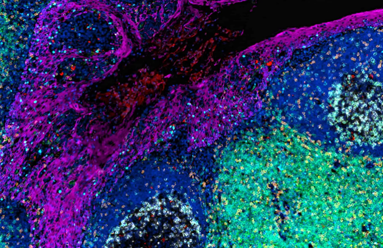 Spatial biology AI could transform oncology R&D